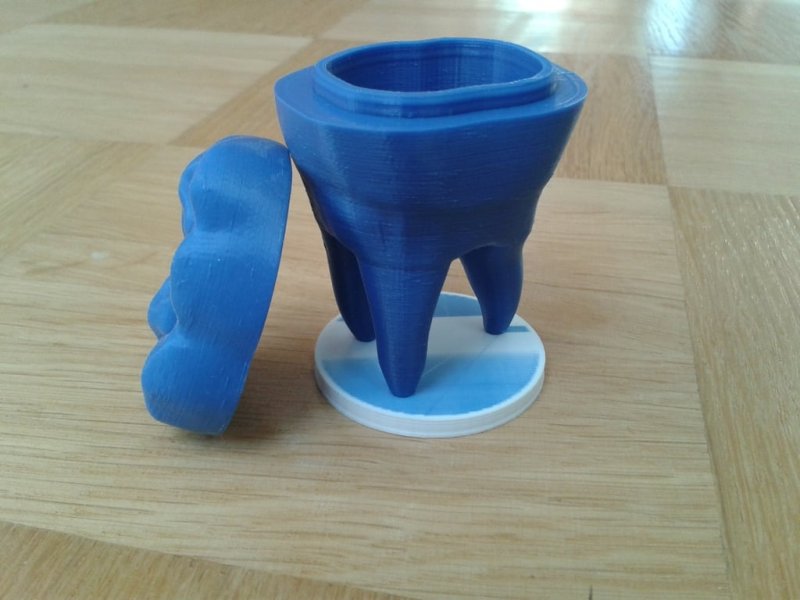 Baby Tooth Box 3D Printer Model Download Free STL File - 3axis.co